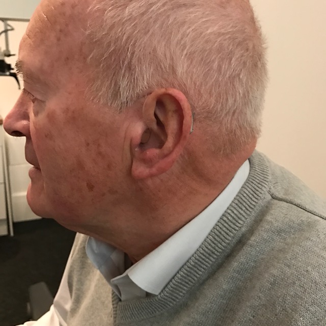 Phonak V90 Naida – Mr Brian Lambe’s experience - Bryce Hearing Services ...